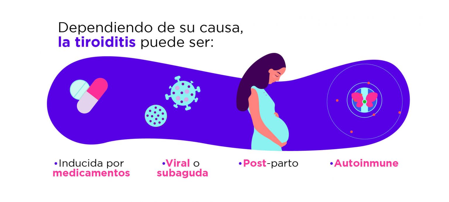 Dependiendo de su causa, la tiroiditis puede ser