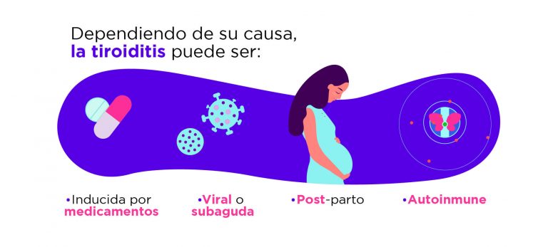 Dependiendo de su causa, la tiroiditis puede ser